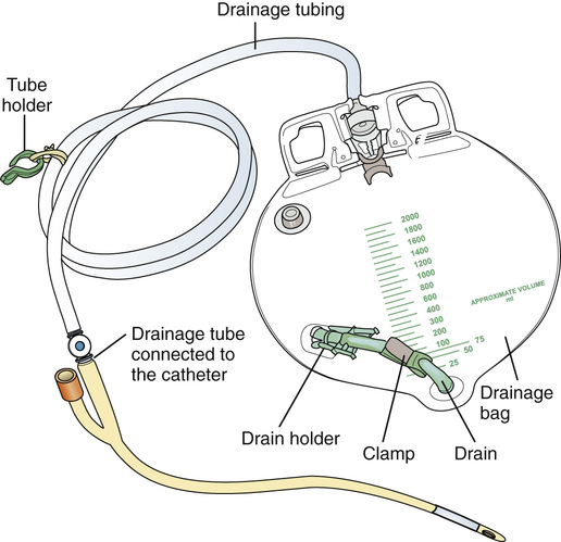 Disposable 2000ml Urine Meter Bag Medical-Grade Drainage System with ...